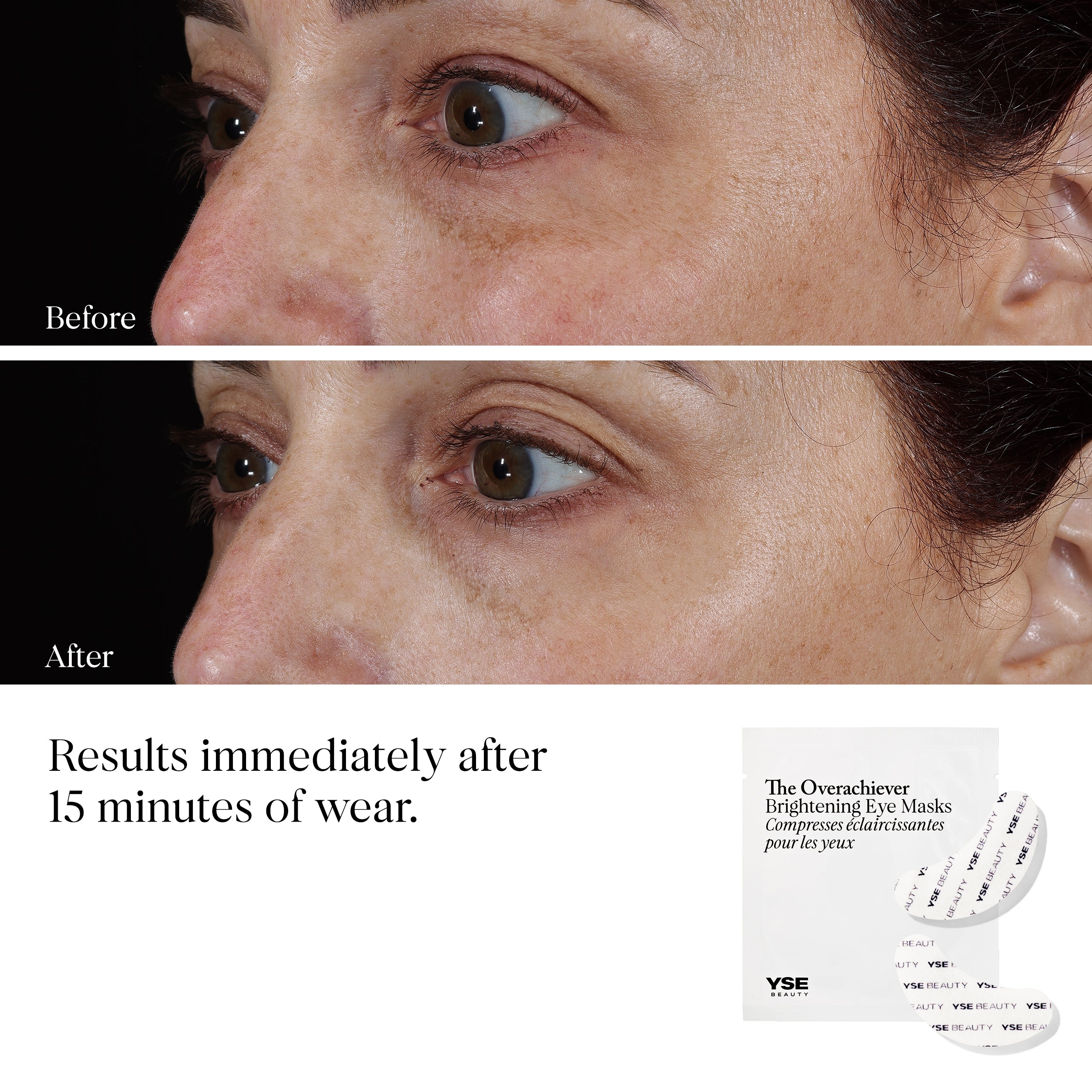 Overachiever Brightening Eye Masks